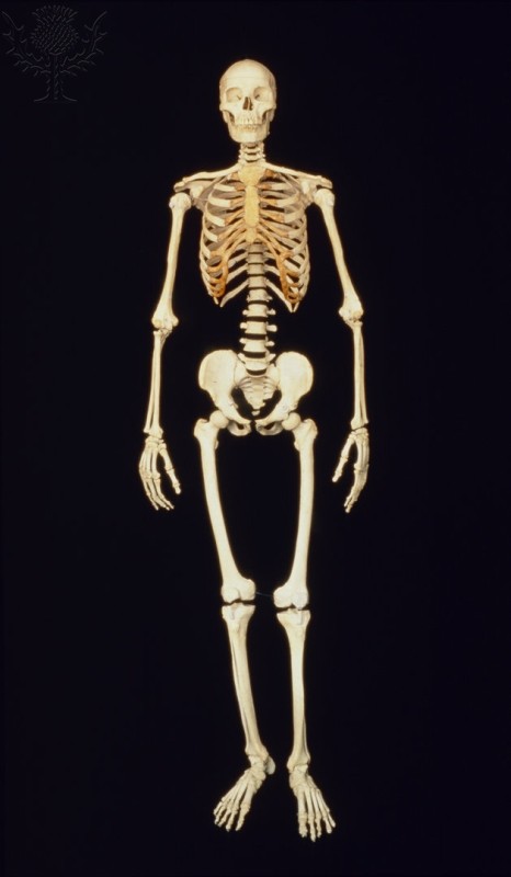 Bones - Anatomical Models - Library Home / LibGuides at Gwinnett Tech ...